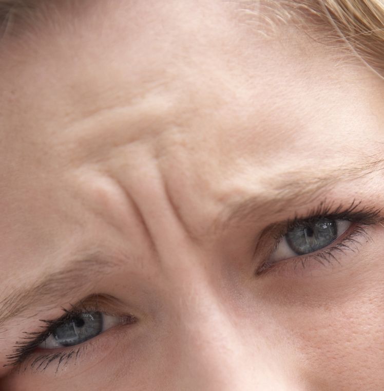 Bunny Lines Botox | Botox On Bunny Lines - The Aesthetics Doctor